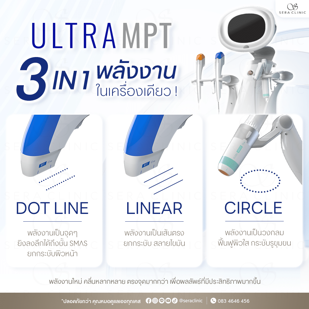 Ultraformer MPT กระชับผิว หน้ายก เก็บกรอบหน้าชัด ที่ Sera Clinic
