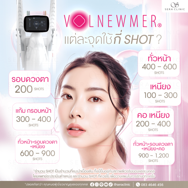 Volnewmer ยกกระชับผิว รีดแฟต กระตุ้นคอลลาเจน อิ่มฟู ที่ Sera Clinic